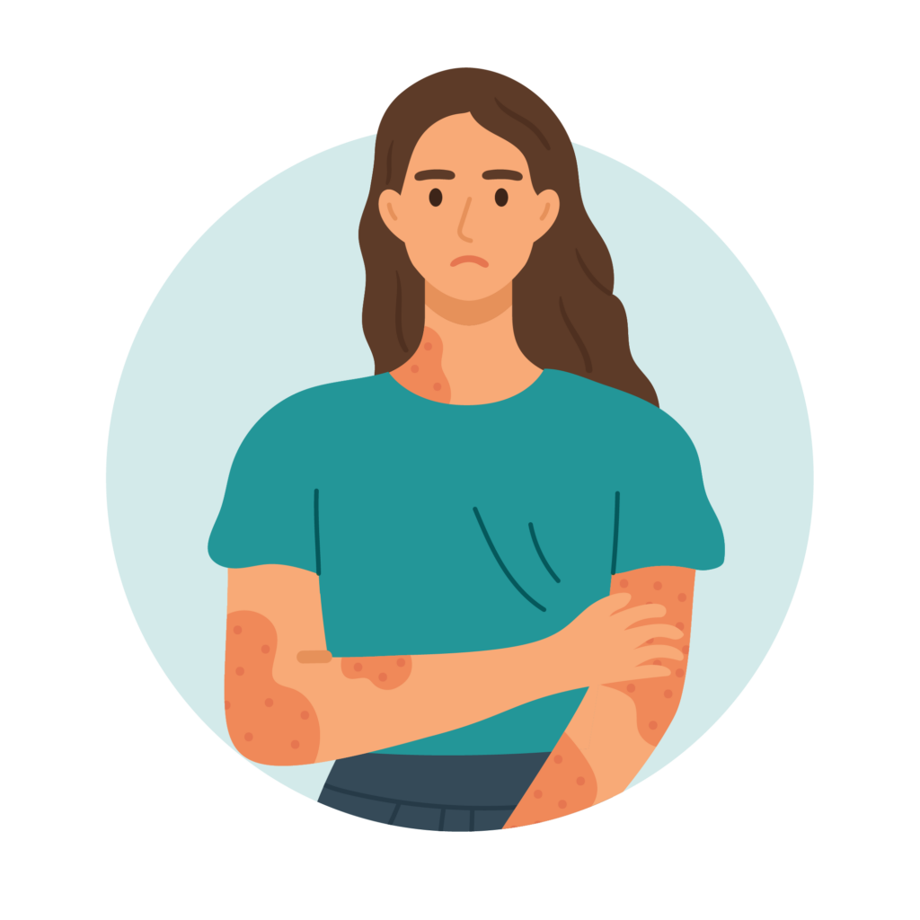 Atopie : définition, symptômes, causes et traitements - Dermatology ...